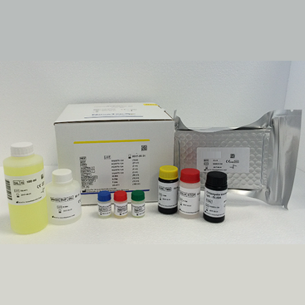 Dengue Virus IgM u Capture – Quimiolab