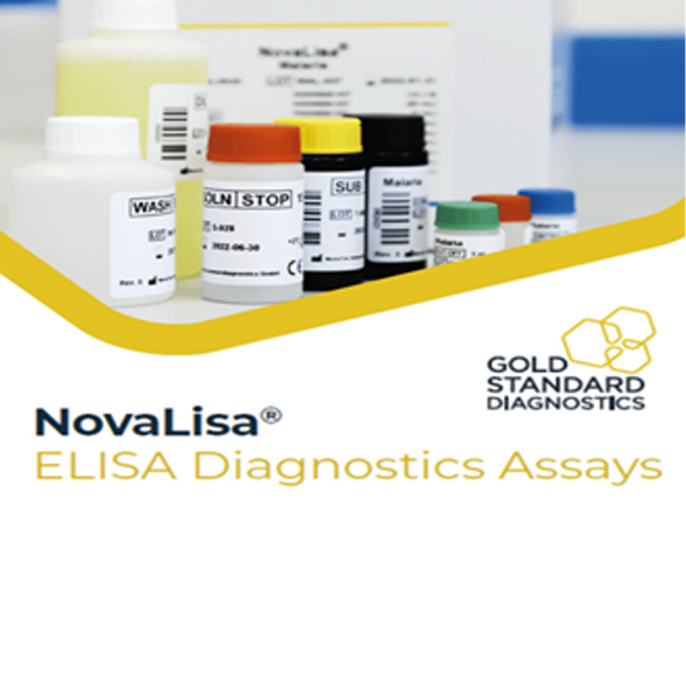 NovaLisa® Varicella Zoster Virus (VZV) IgM ELISA – Quimiolab